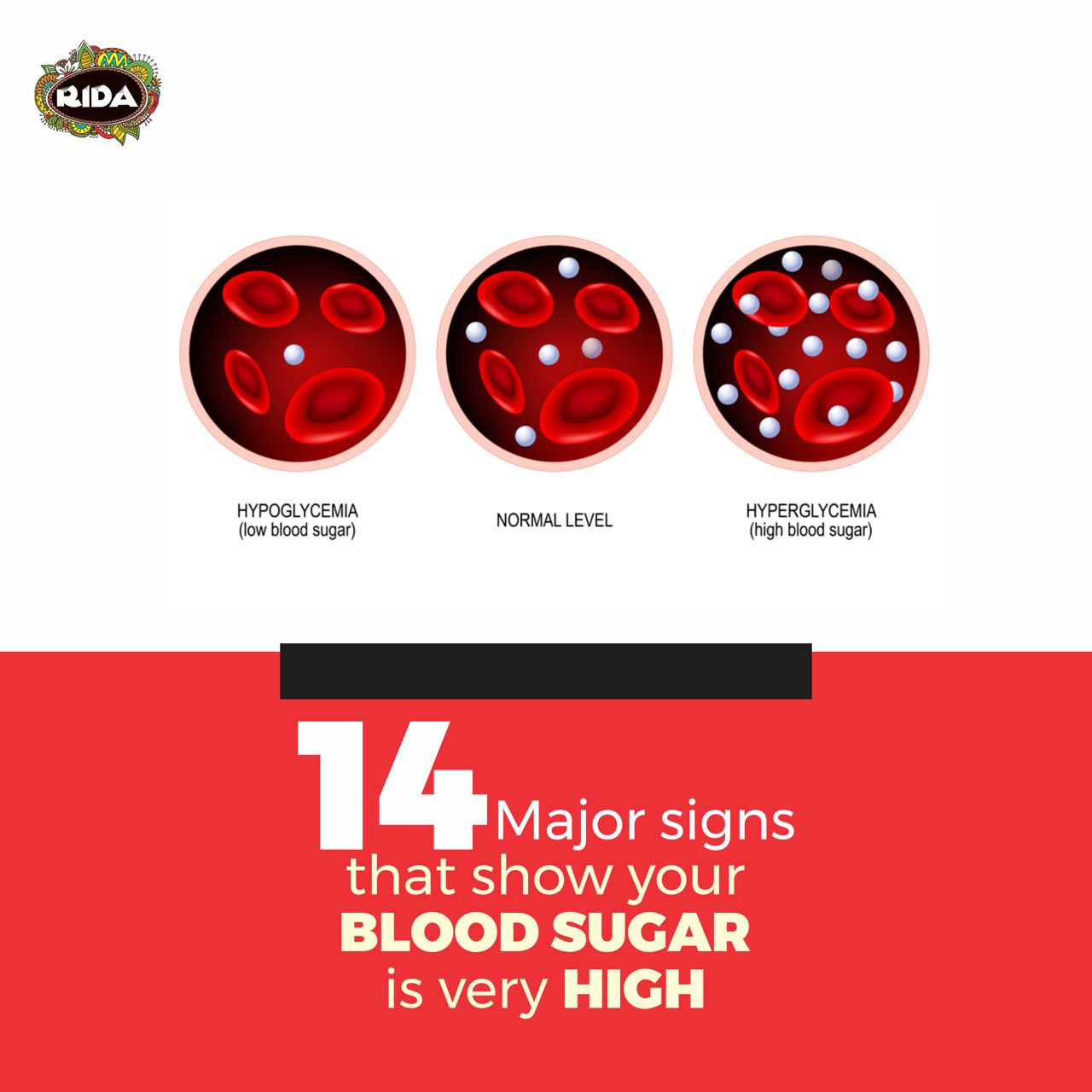 14 major signs that show your blood sugar is very high – Rida Natural
